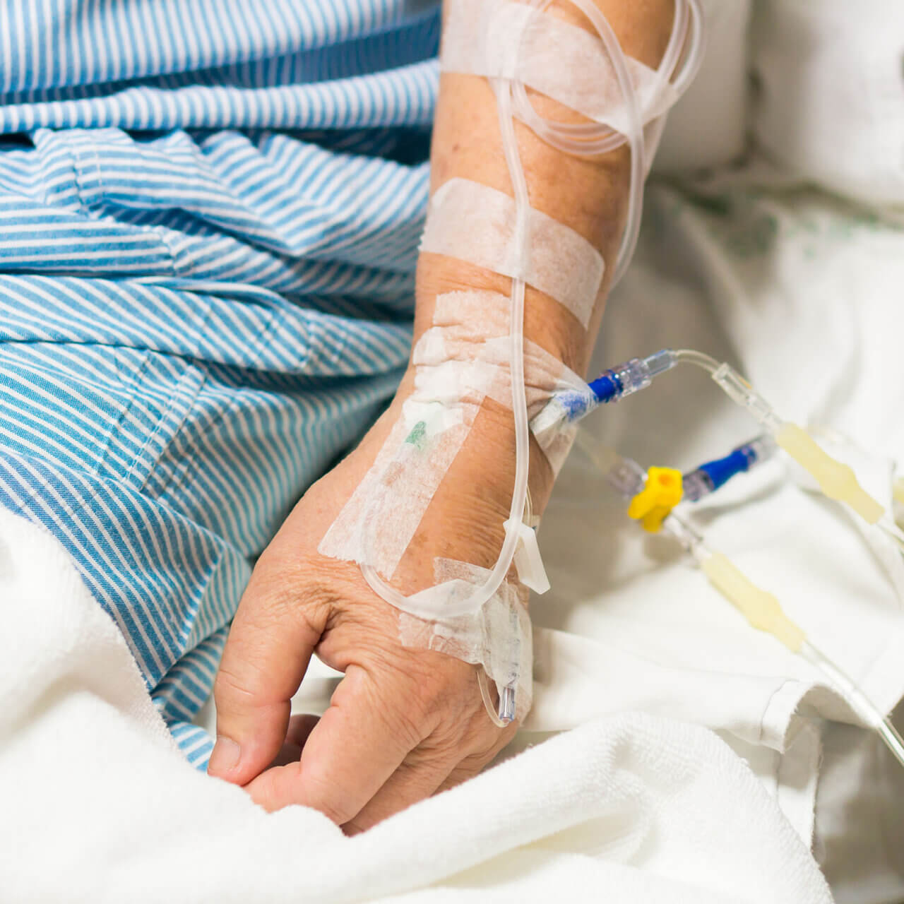IV Glove - The revolutionary securement system you can trust