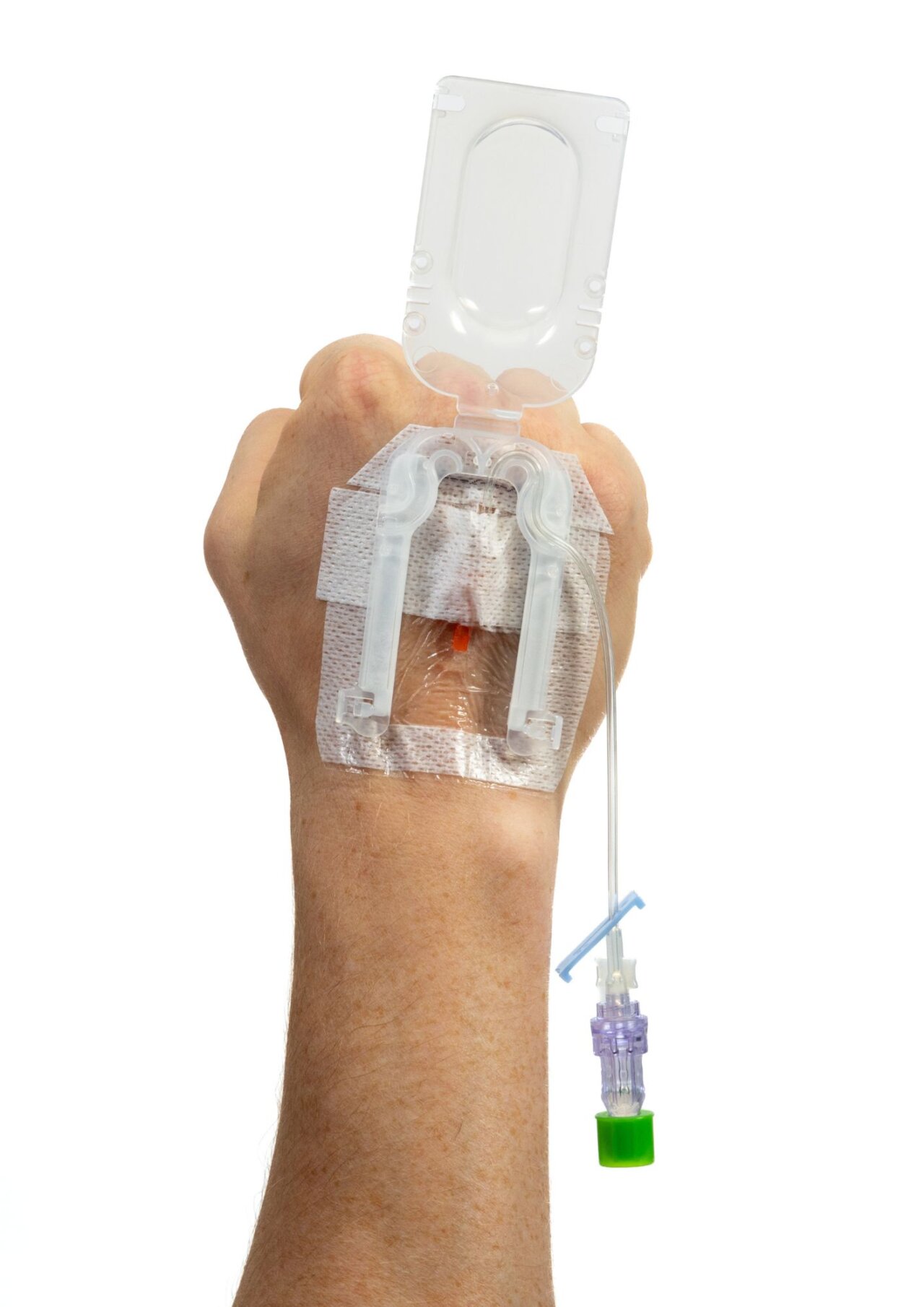 IV Glove - The revolutionary securement system you can trust