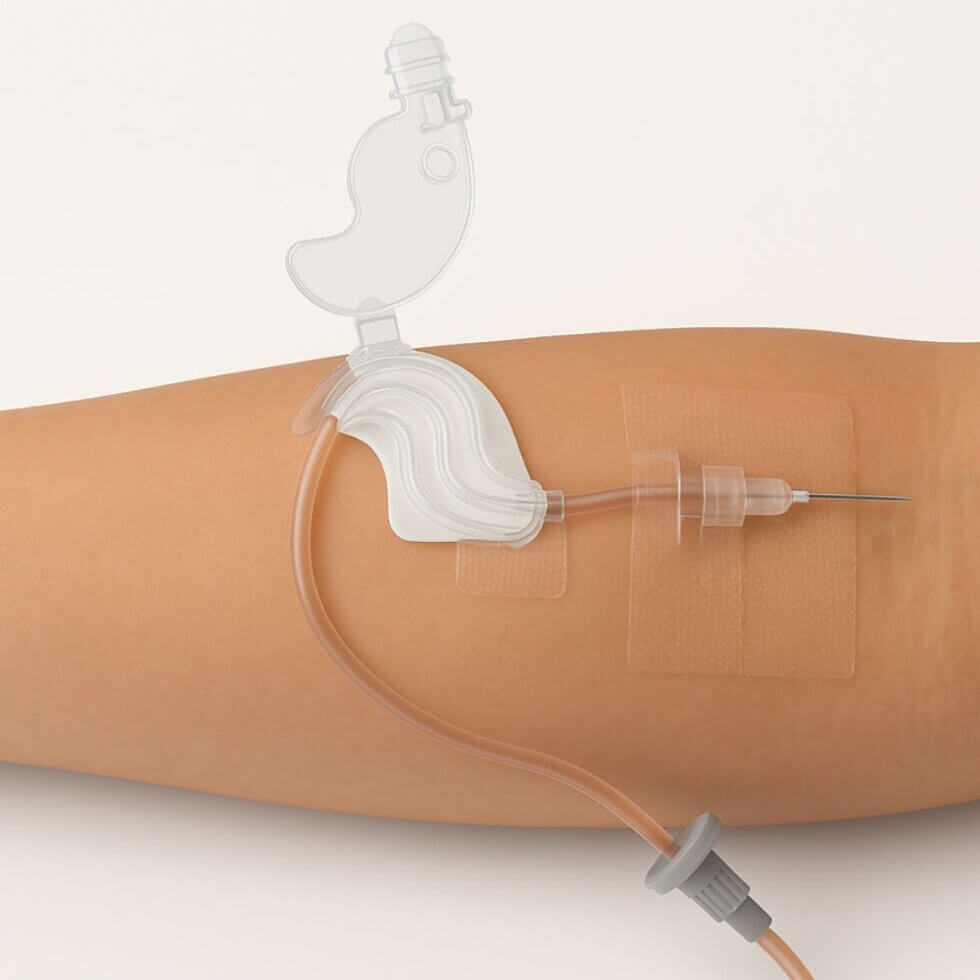 What’s New - IV Glove